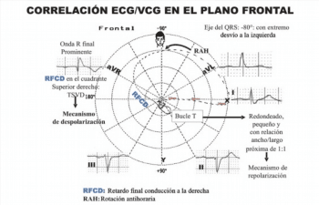 Eje Electrico Electrocardiograma Pdf Free INSTALL - Collection | OpenSea